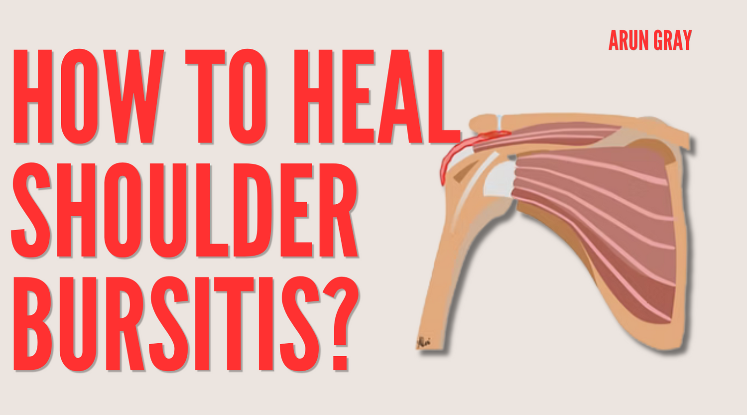 How to Heal Shoulder Bursitis: A Complete Recovery Guide (2025) – AG ...