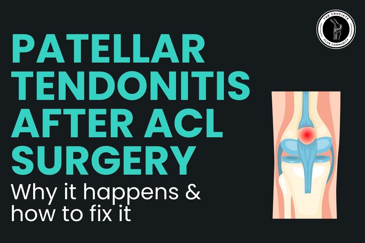 Patellar Tendonitis After ACL Surgery: Why It Happens & How to Fix It ...