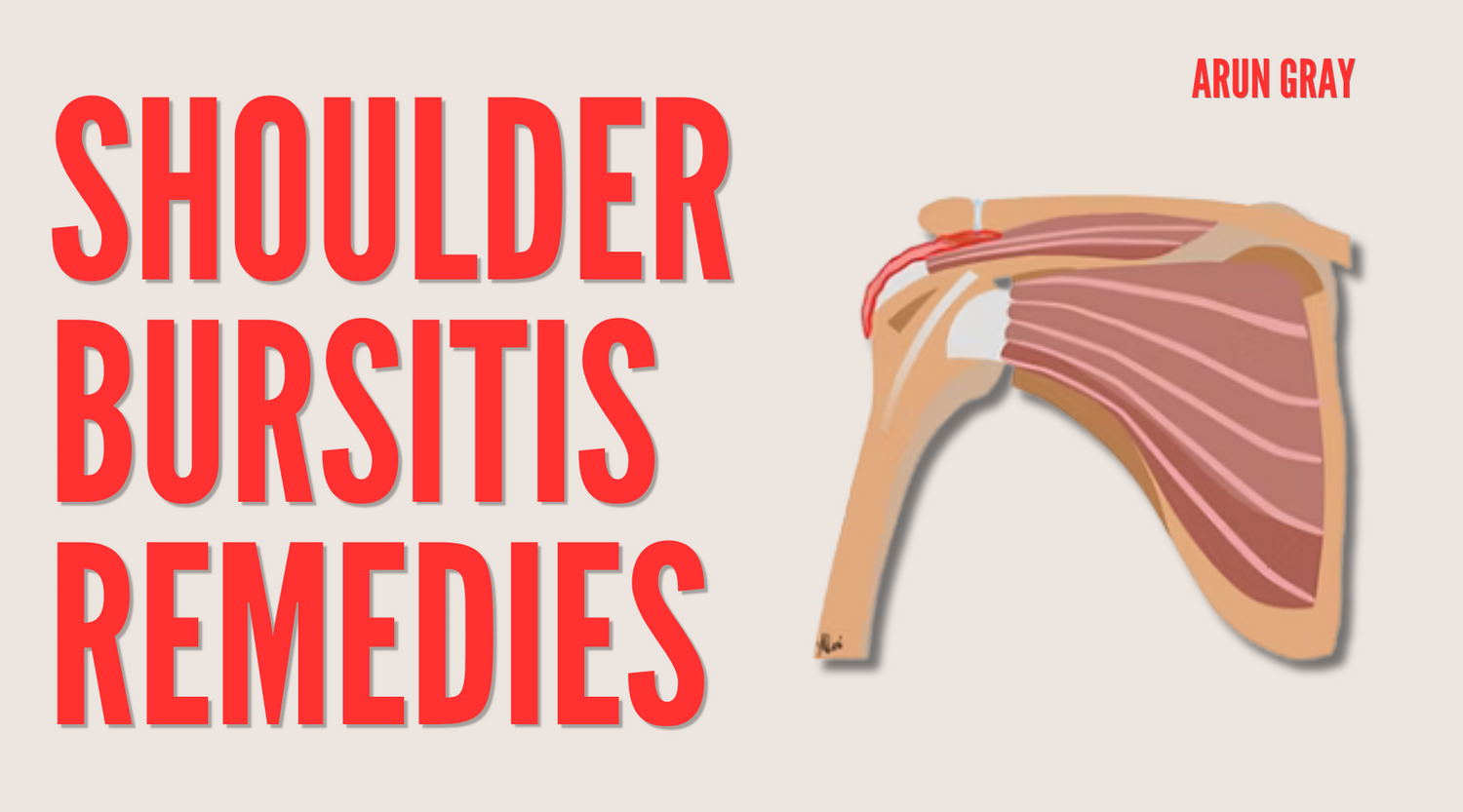 12 Proven Shoulder Bursitis Remedies: From Quick Relief to Healing – AG ...