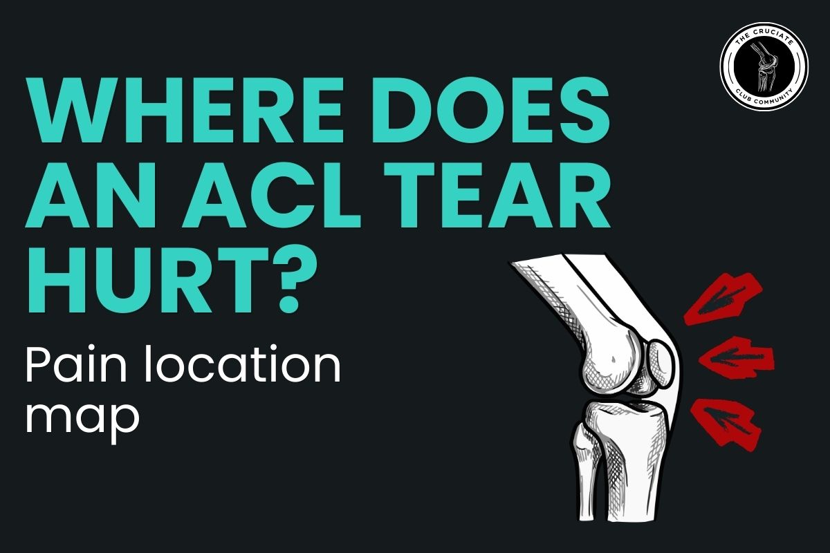 ACL Injury Pain Location: Where Does It Hurt? Injury Pain Location Map ...